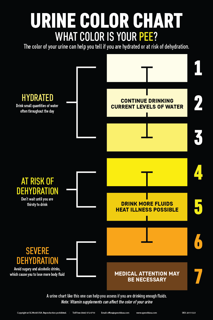 Heat Stress Awareness - Urine Chart Sign